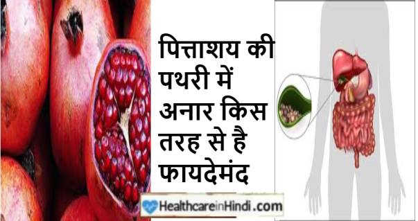 पित्ताशय की पथरी में अनार फायदेमंद है? | Pitt Pathri or Anar